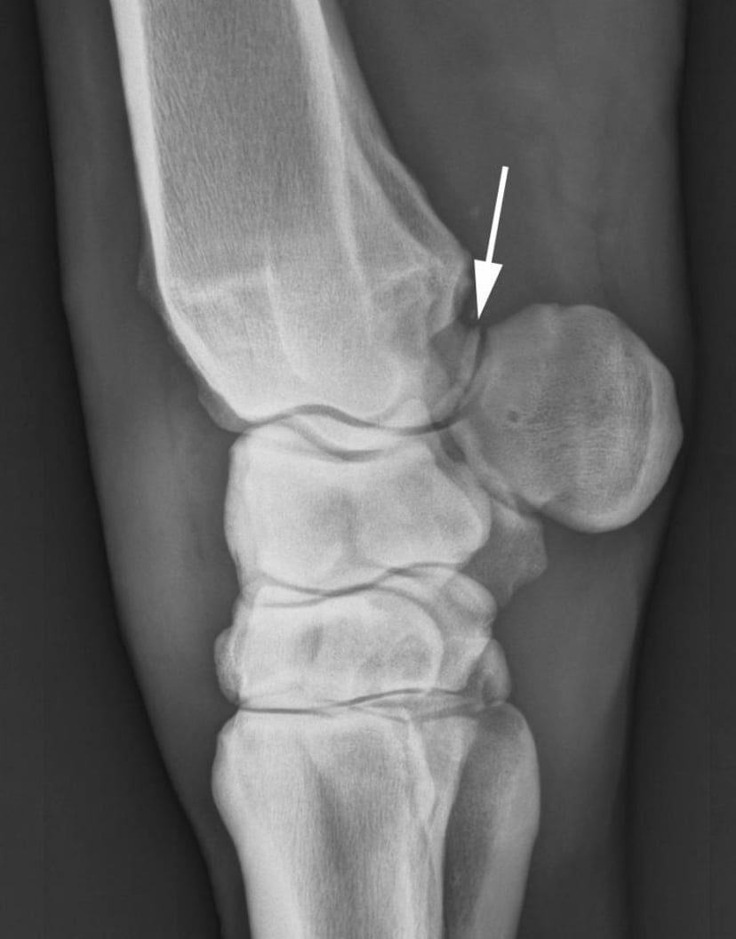 Fractura de los huesos carpianos en caballos - Sistema ...