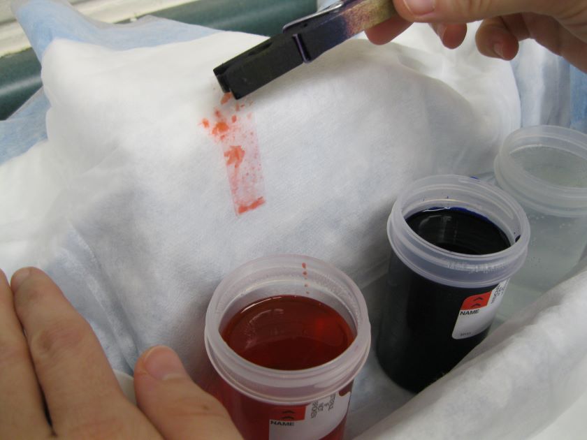 Image:Acetate tape staining-MSD Veterinary Manual