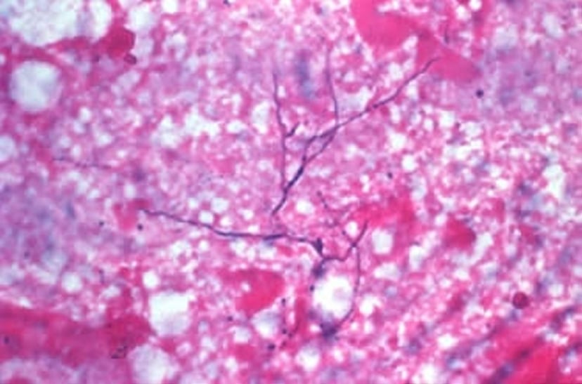 Image:Actinomyces bovis, Gram-stained smear, cow-Merck Veterinary Manual