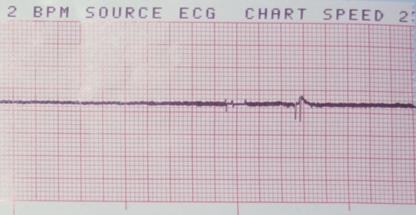 Image:Asystole, ECG tracing-Merck Veterinary Manual