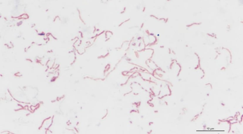 Image:Avibacterium paragallinarum-MSD Veterinary Manual