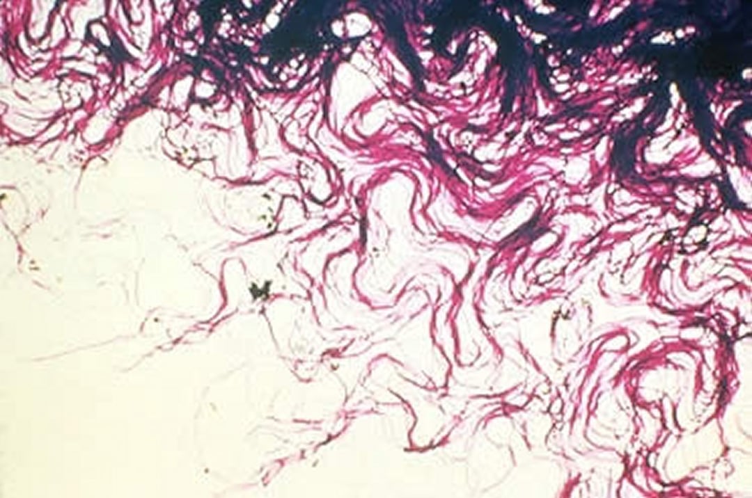 Image:Bacillus anthracis, medusa head morphology-MSD Veterinary Manual
