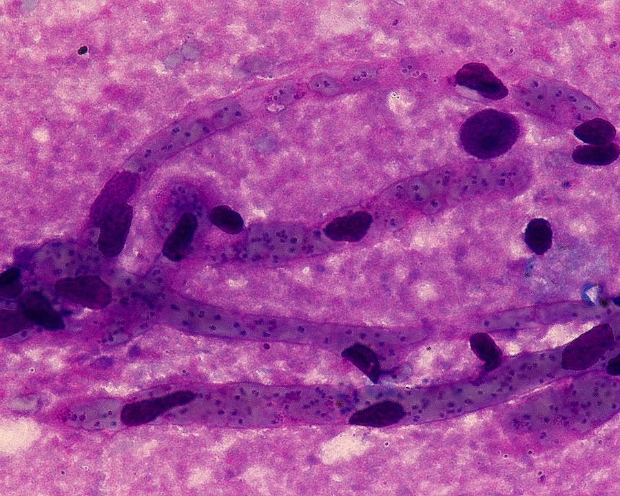 Image:Babesia bovis, brain smear, cow-MSD Veterinary Manual