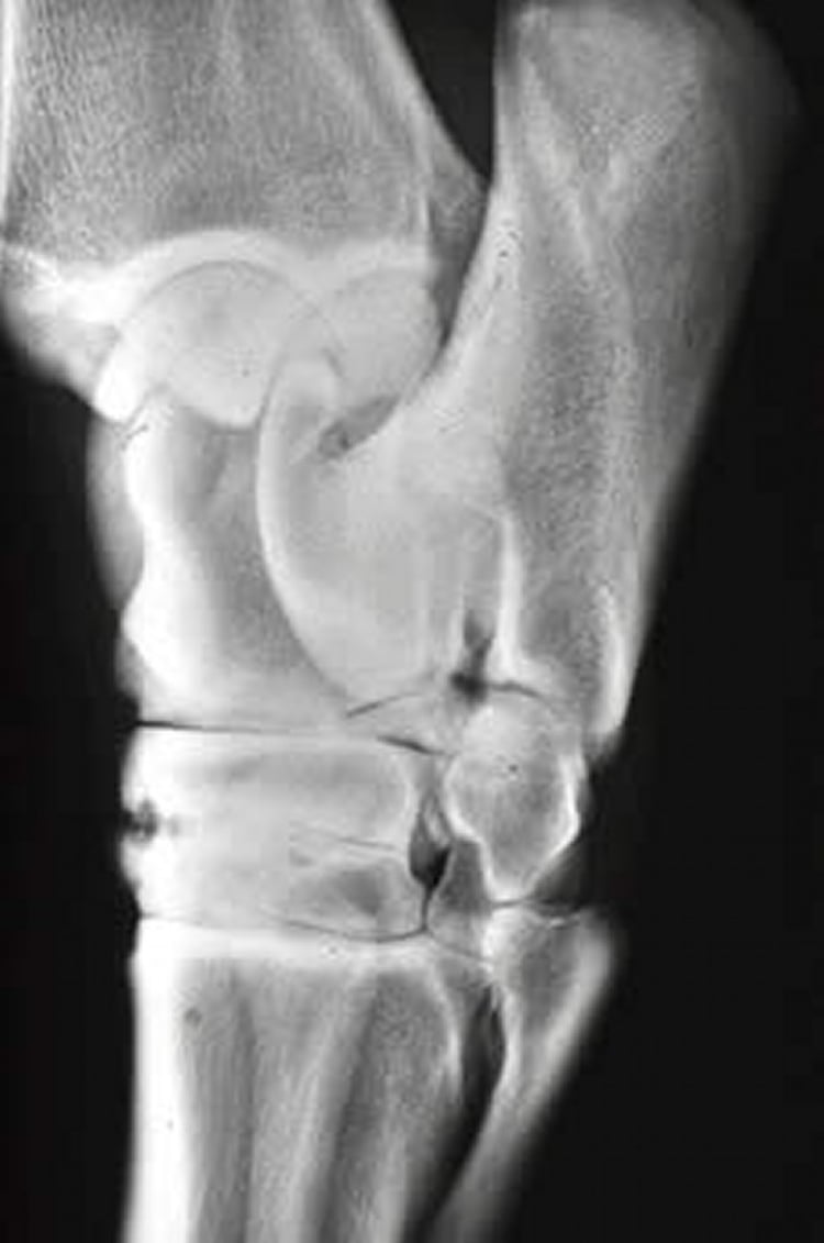 Osteoarthritis of the Distal Tarsal Joints in Horses - Musculoskeletal ...