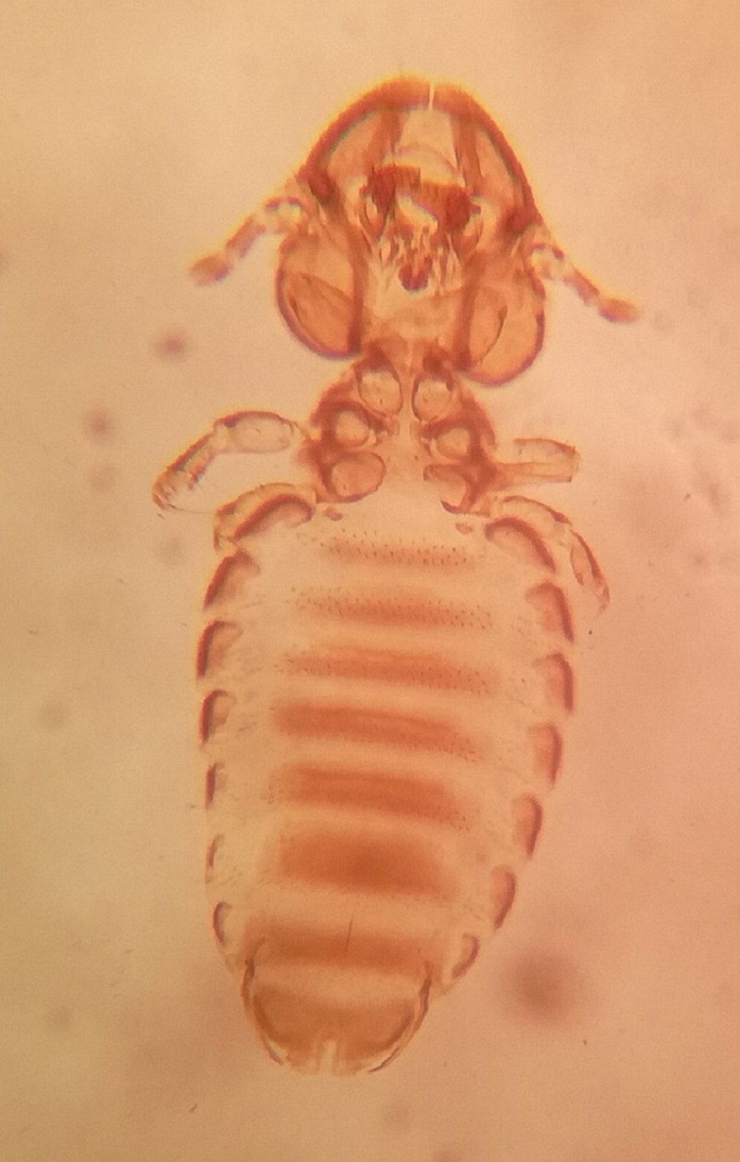 Lice in Cattle - Integumentary System - MSD Veterinary Manual