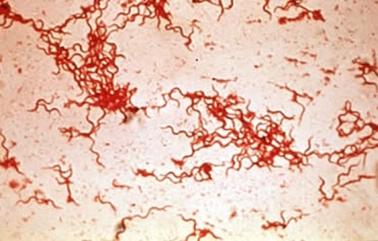 Swine Dysentery - Digestive System - Merck Veterinary Manual