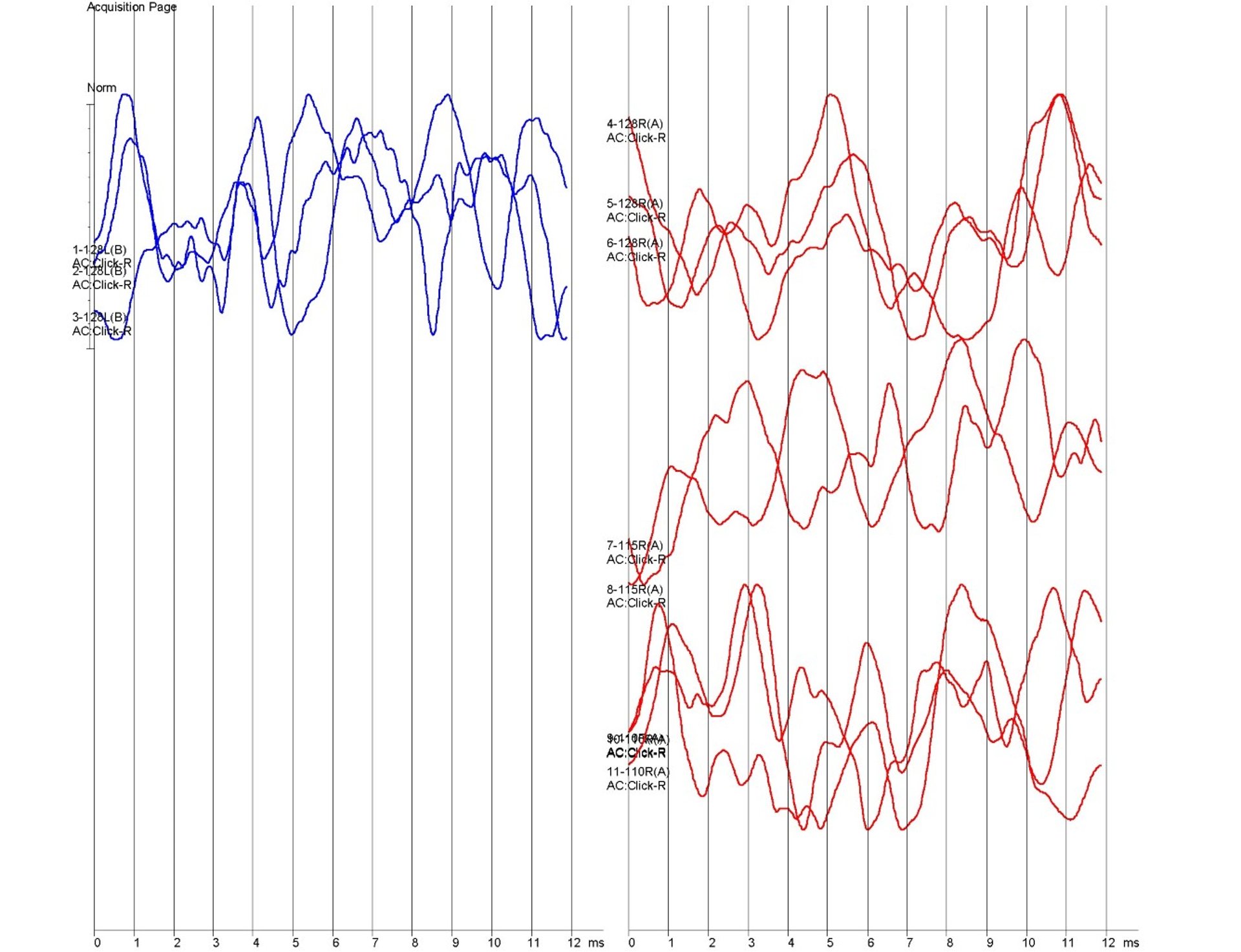 Image:Brainstem auditory evoked response (BAER) testing output ...