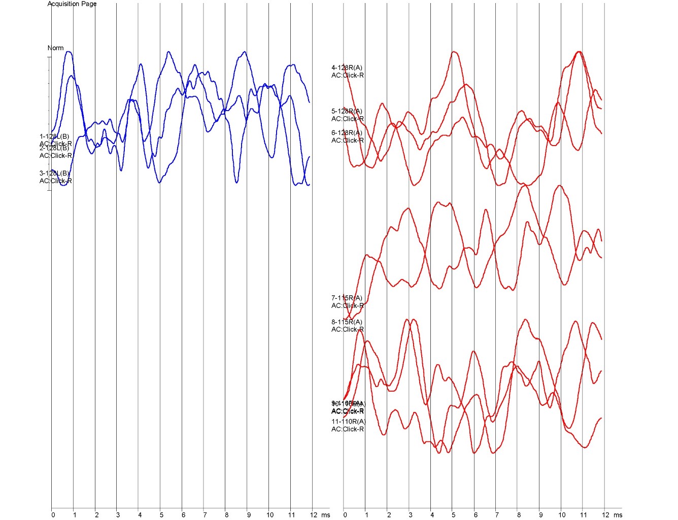 Image:Brainstem auditory evoked response (BAER) testing output ...