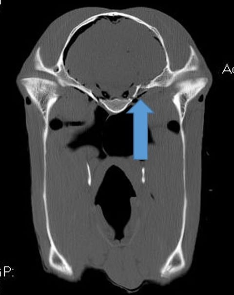 Image:Basisphenoid fracture, CT scan, horse-Merck Veterinary Manual