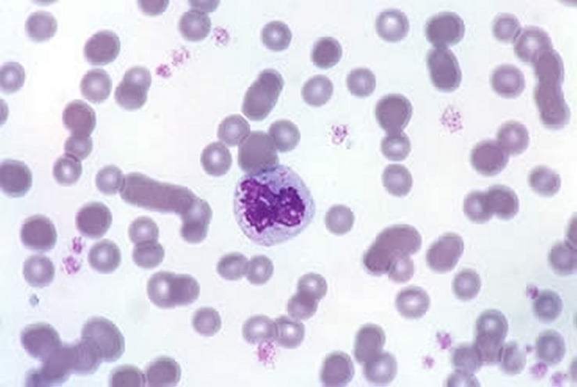 Image:Blood smear, platelets, cat-Merck Veterinary Manual