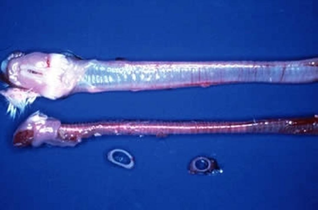 Image:Bordetella avium, flattened trachea, turkey-MSD Veterinary Manual