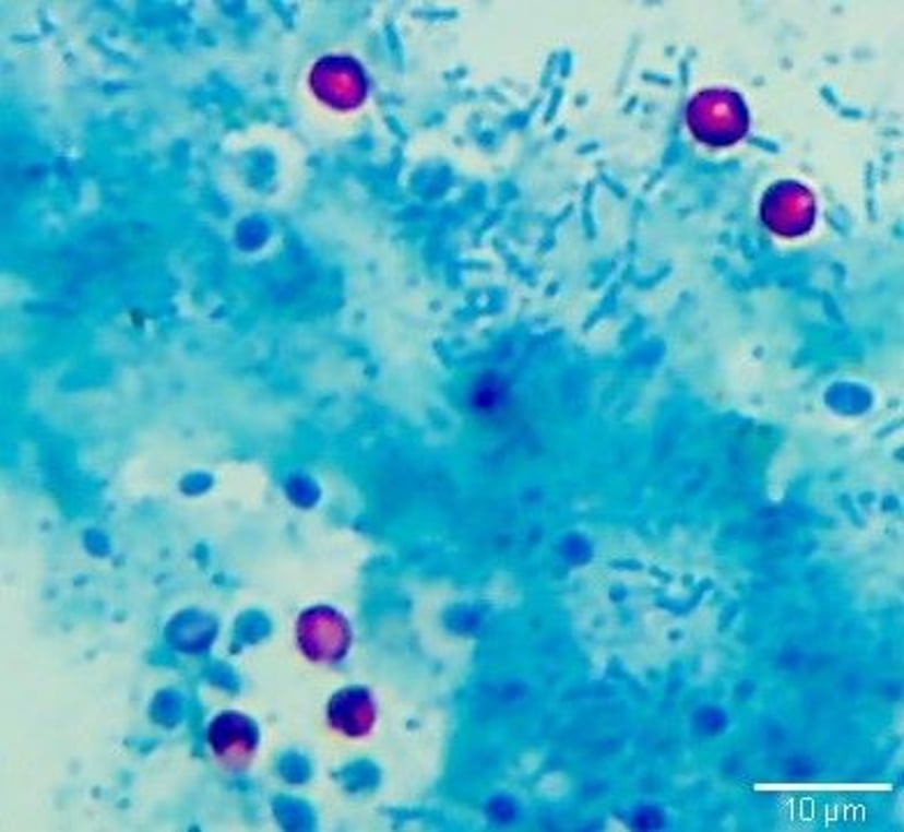 Image:Cryptosporidium parvum oocysts, fecal smear, photomicrograph ...