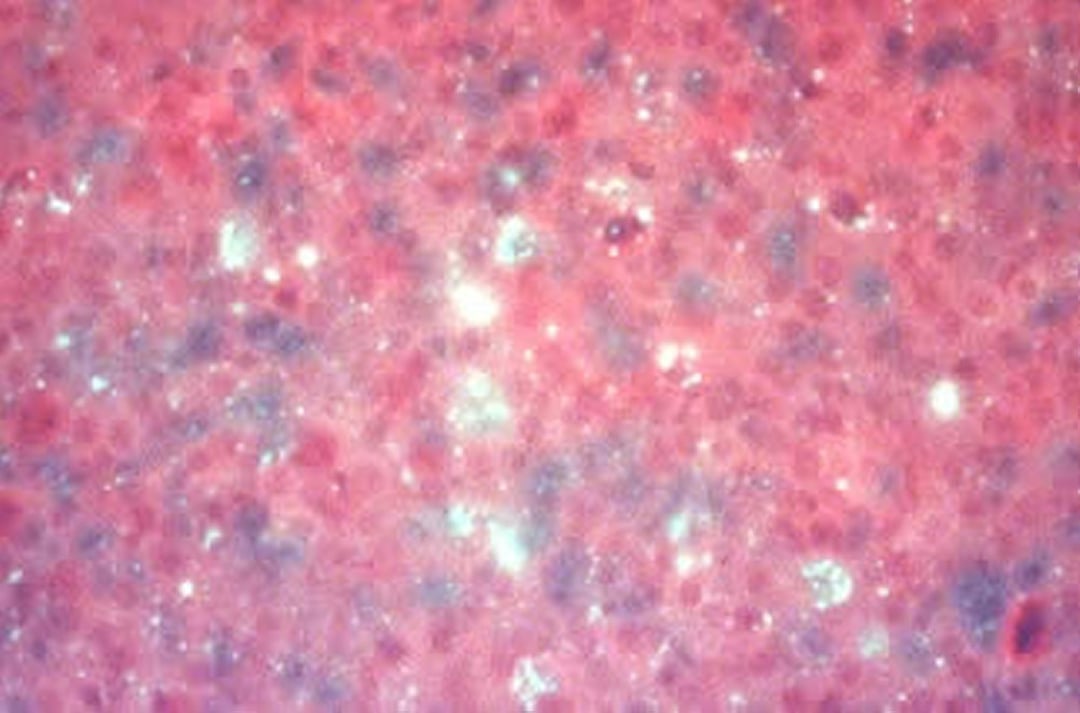 Avian Chlamydiosis - Poultry - MSD Veterinary Manual
