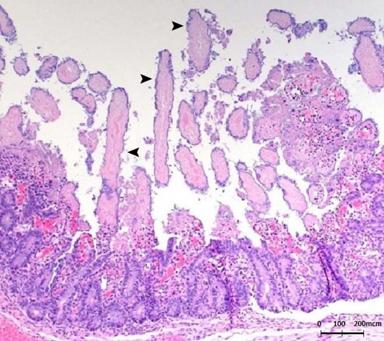 Clostridium perfringens Type C Enteritis in Pigs - Digestive System ...