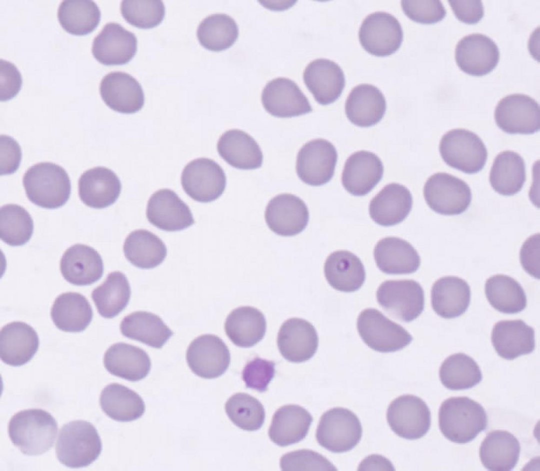 Cytauxzoonosis in Cats - Circulatory System - Merck Veterinary Manual