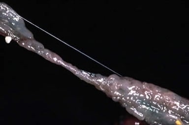 Helminthiasis in Poultry - Poultry - MSD Veterinary Manual