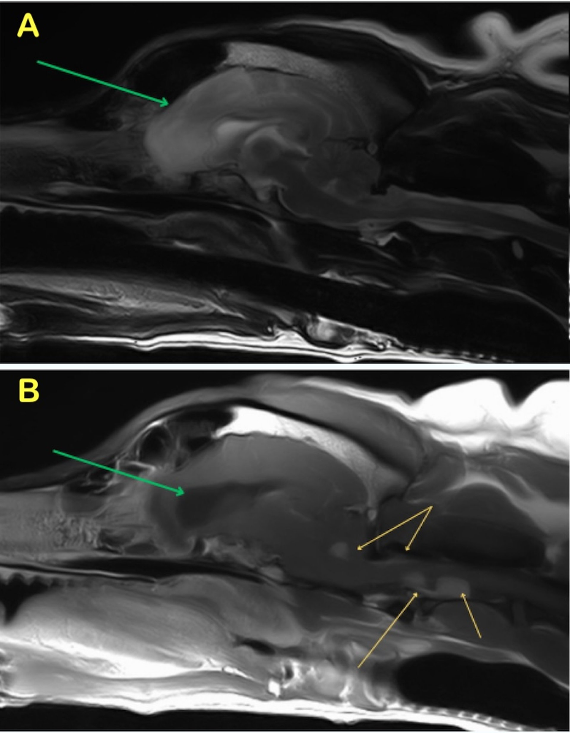 Image:Choroid plexus tumor, MRI, dog-MSD Veterinary Manual