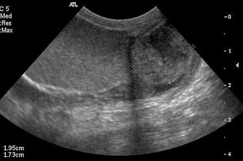 Image:Chronic epididymitis, enlarged epididymis, ultrasonogram, dog-MSD ...