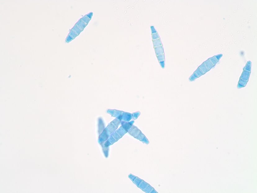 Image:Classic microscopic appearance, Nannizzia gypsea-MSD Veterinary ...