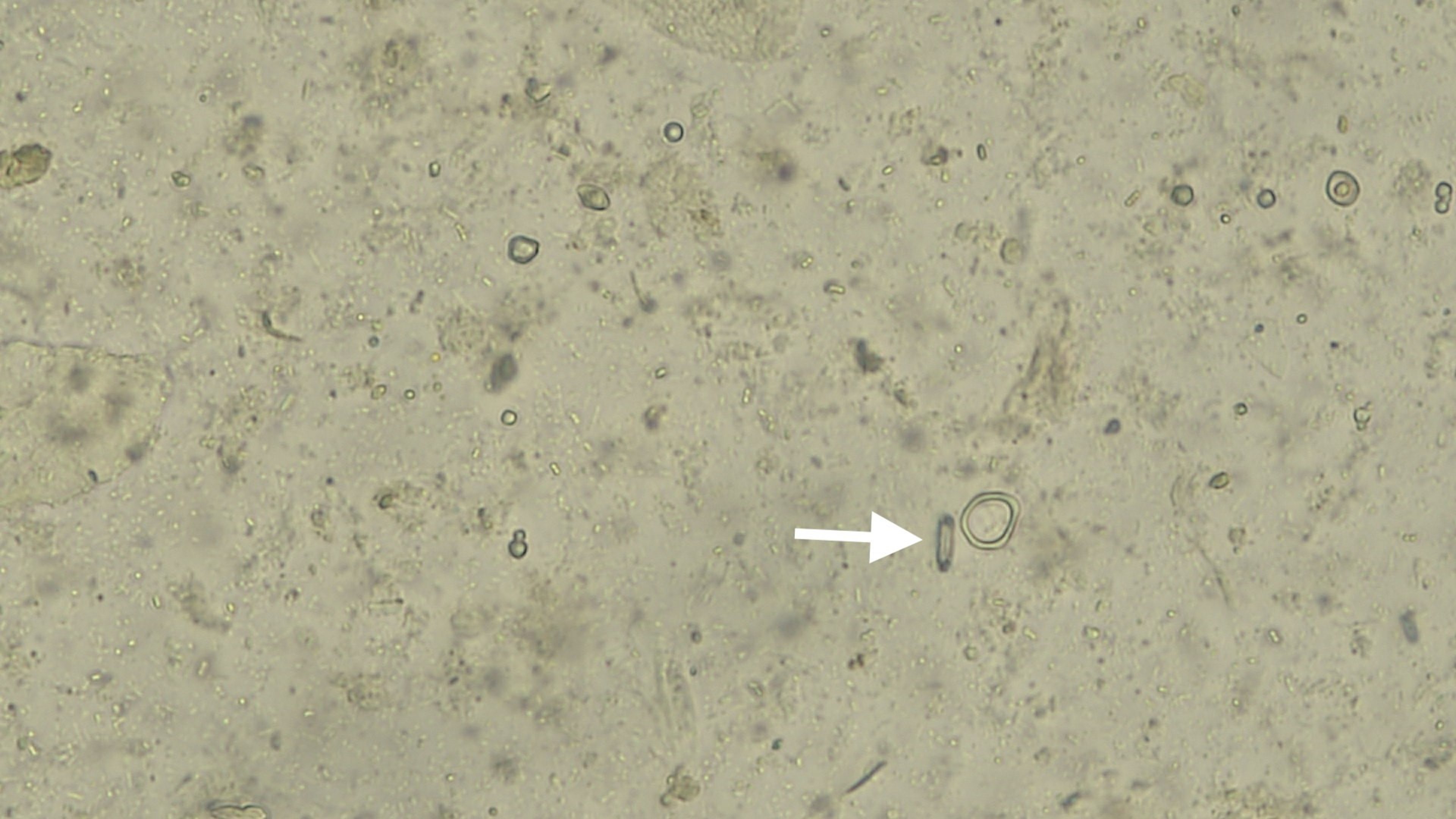 Image:Clostridium, rabbit fecal smear-Manual MSD de veterinária