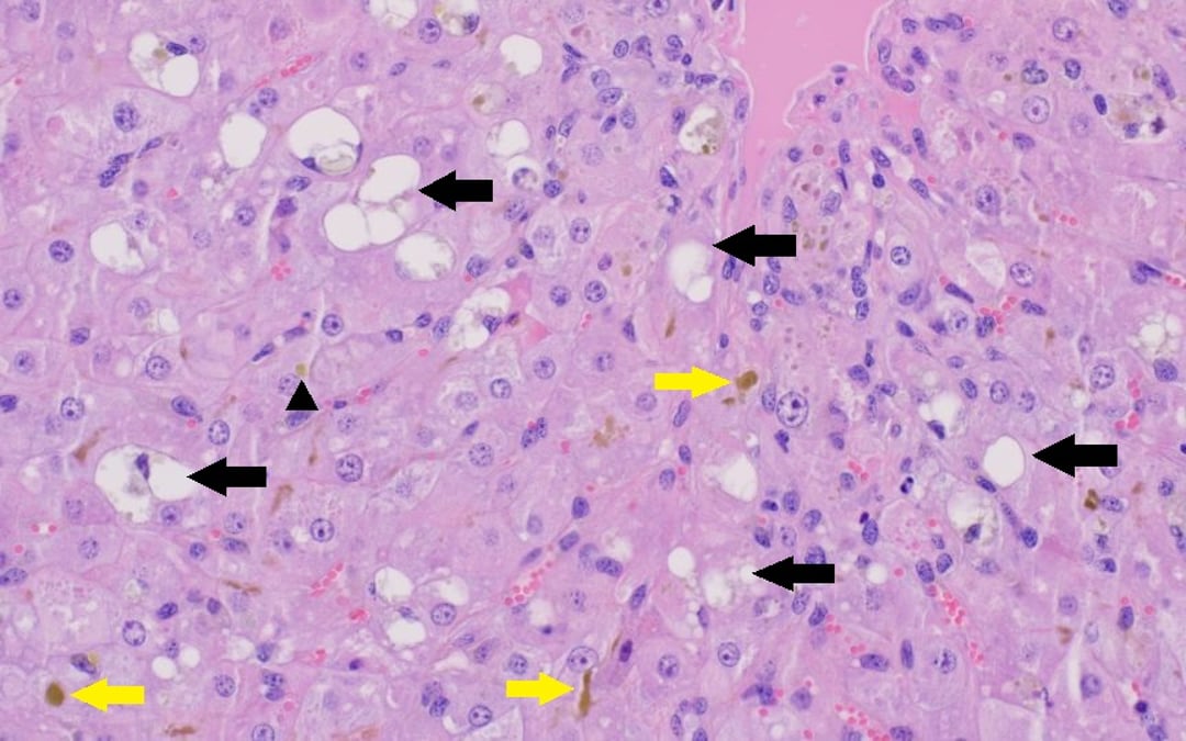 Copper Toxicosis in Animals - Toxicology - MSD Veterinary Manual
