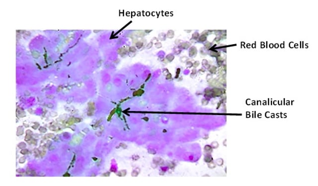 Biliary Tree (Biliary Tract): Intrahepatic and Extrahepatic Components ...