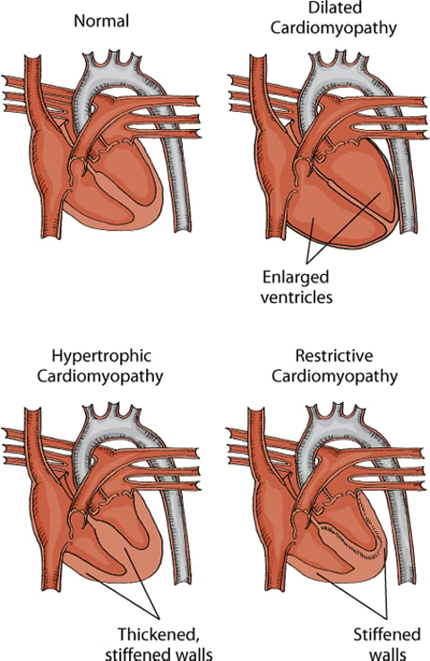 Acquired Heart and Blood Vessel Disorders in Cats - Cat Owners - MSD ...