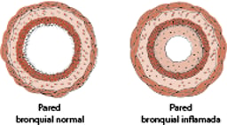Traqueobronquitis (bronquitis) en los perros - Propietarios de perros ...