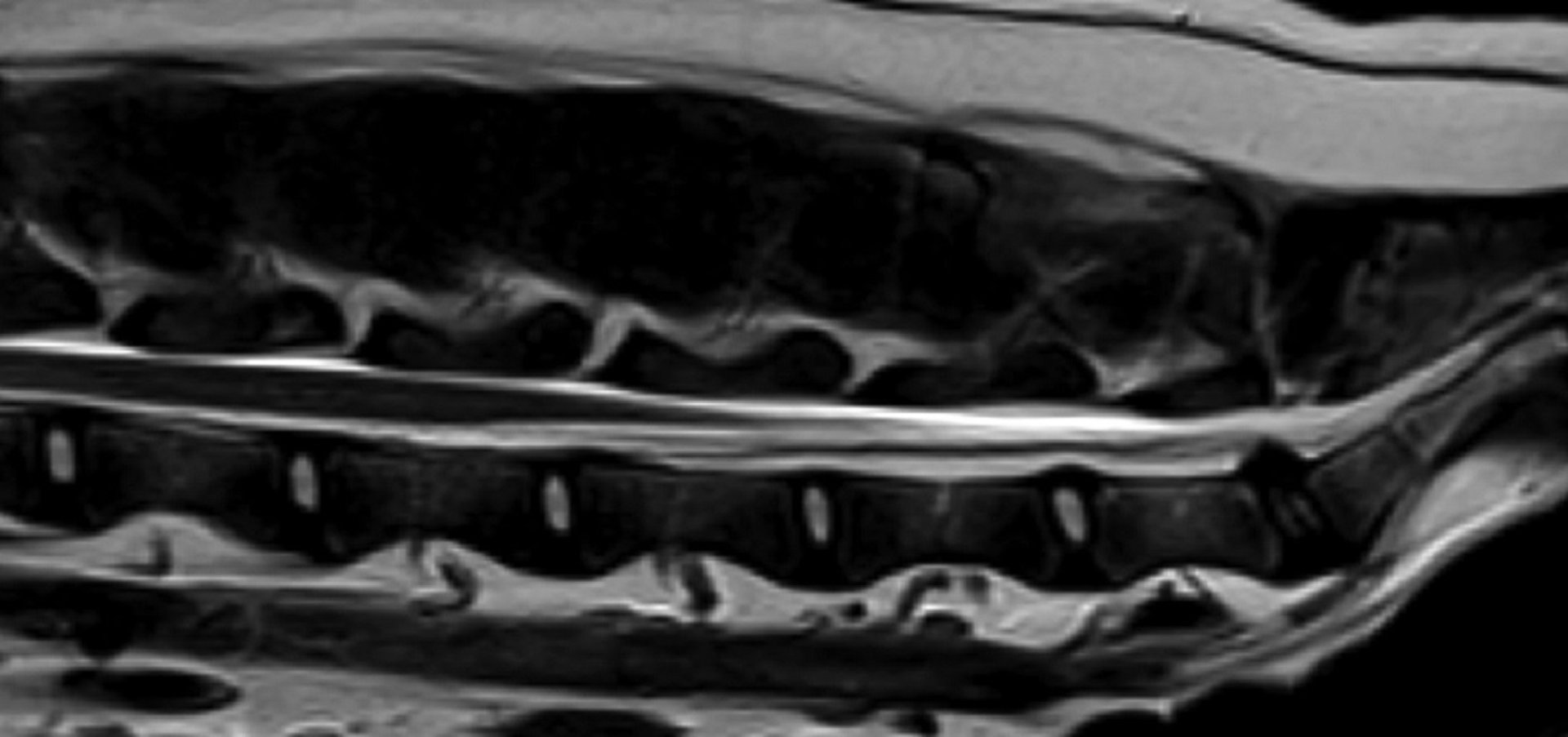 Degenerative Diseases of the Spinal Column and Cord in Animals ...