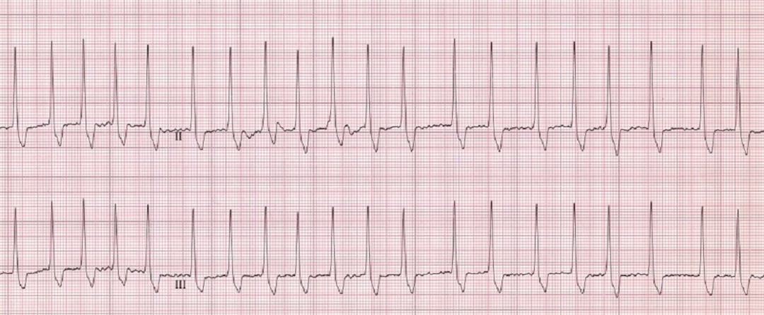 Heart Disease: Conduction Abnormalities in Dogs and Cats - Circulatory ...