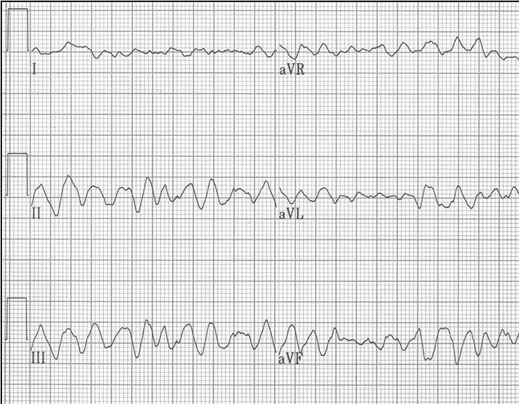 Heart Disease: Conduction Abnormalities in Dogs and Cats - Circulatory ...