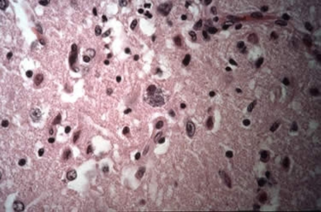 Image:Intracellular cysts of Encephalitozoon cuniculi, brain, rabbit ...