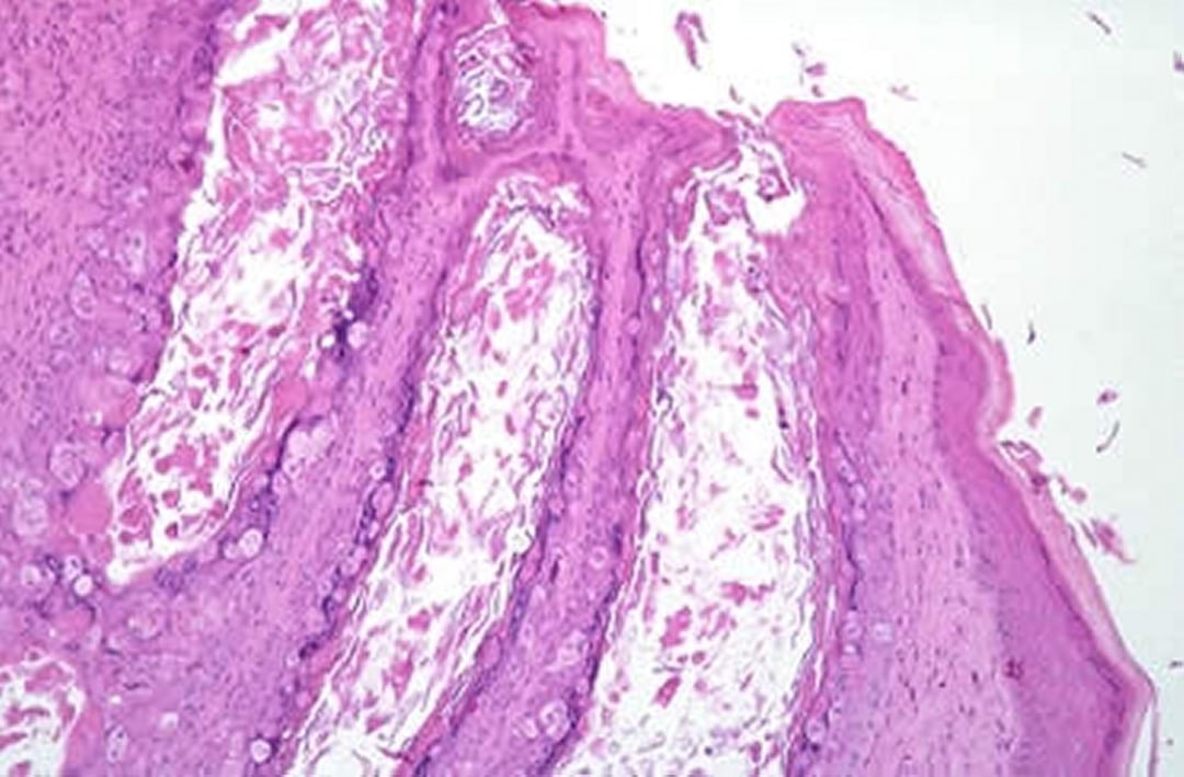 Viral Diseases of Rabbits - Exotic and Laboratory Animals - MSD ...