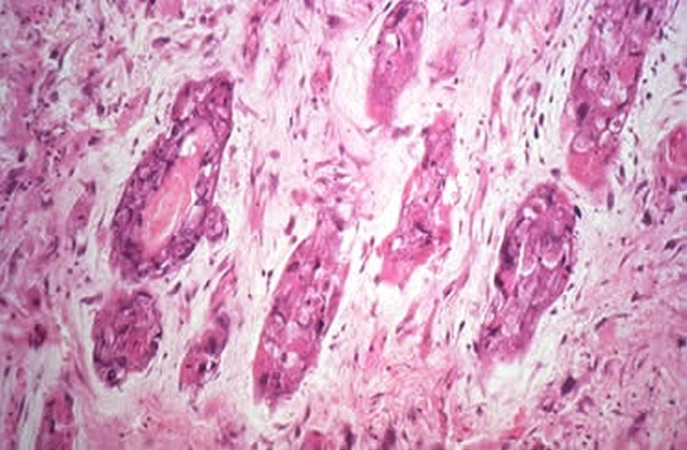 Image:Myxomatosis, rabbit-MSD Veterinary Manual