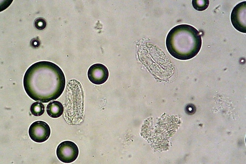 Image:Embryonated ova characteristic of both Rhabdias and Strongyloides ...