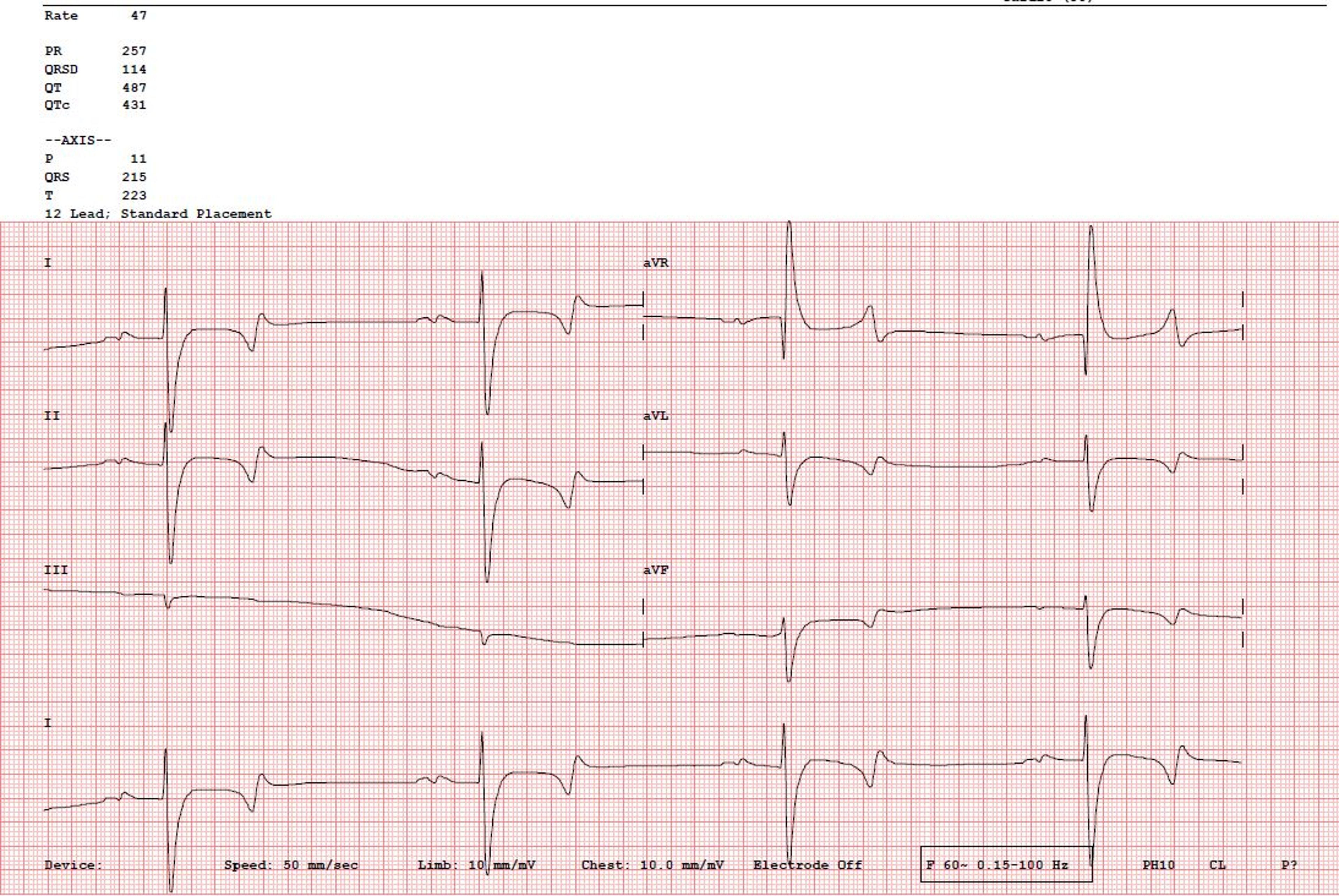Image:ECG, caballo-Manual de veterinaria de MSD