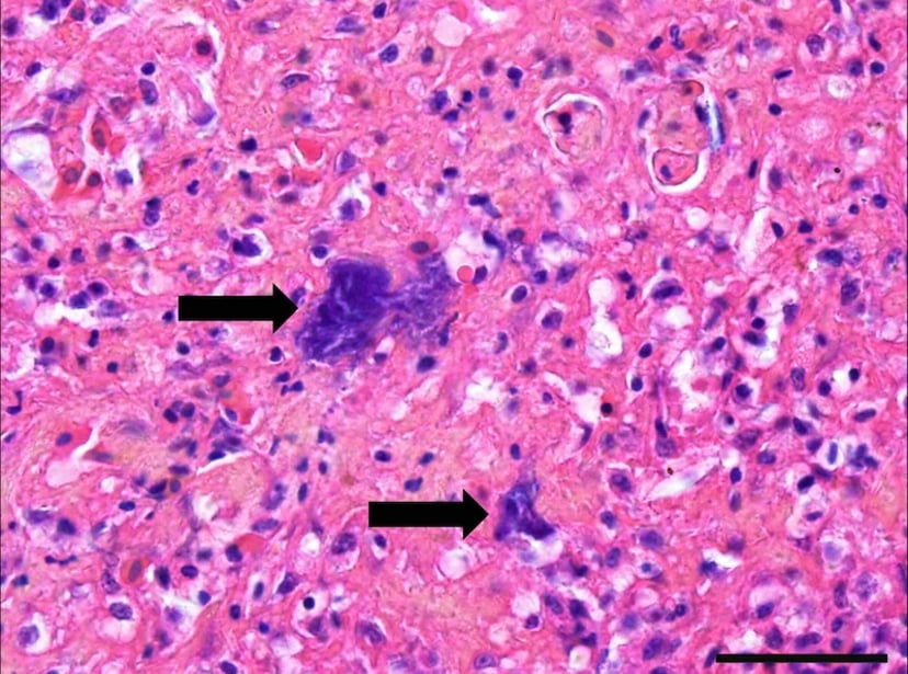 Erysipelas in Poultry - Erysipelas in Poultry - MSD Veterinary Manual