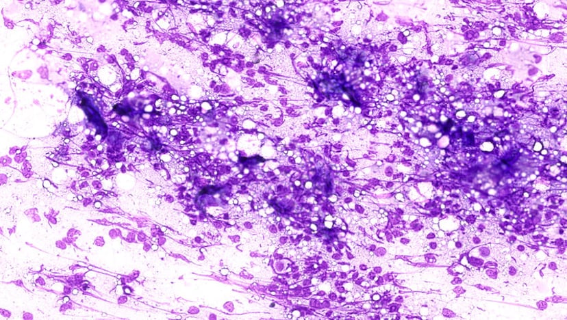 Image:Excessive cytolysis (cell lysis)-Merck Veterinary Manual