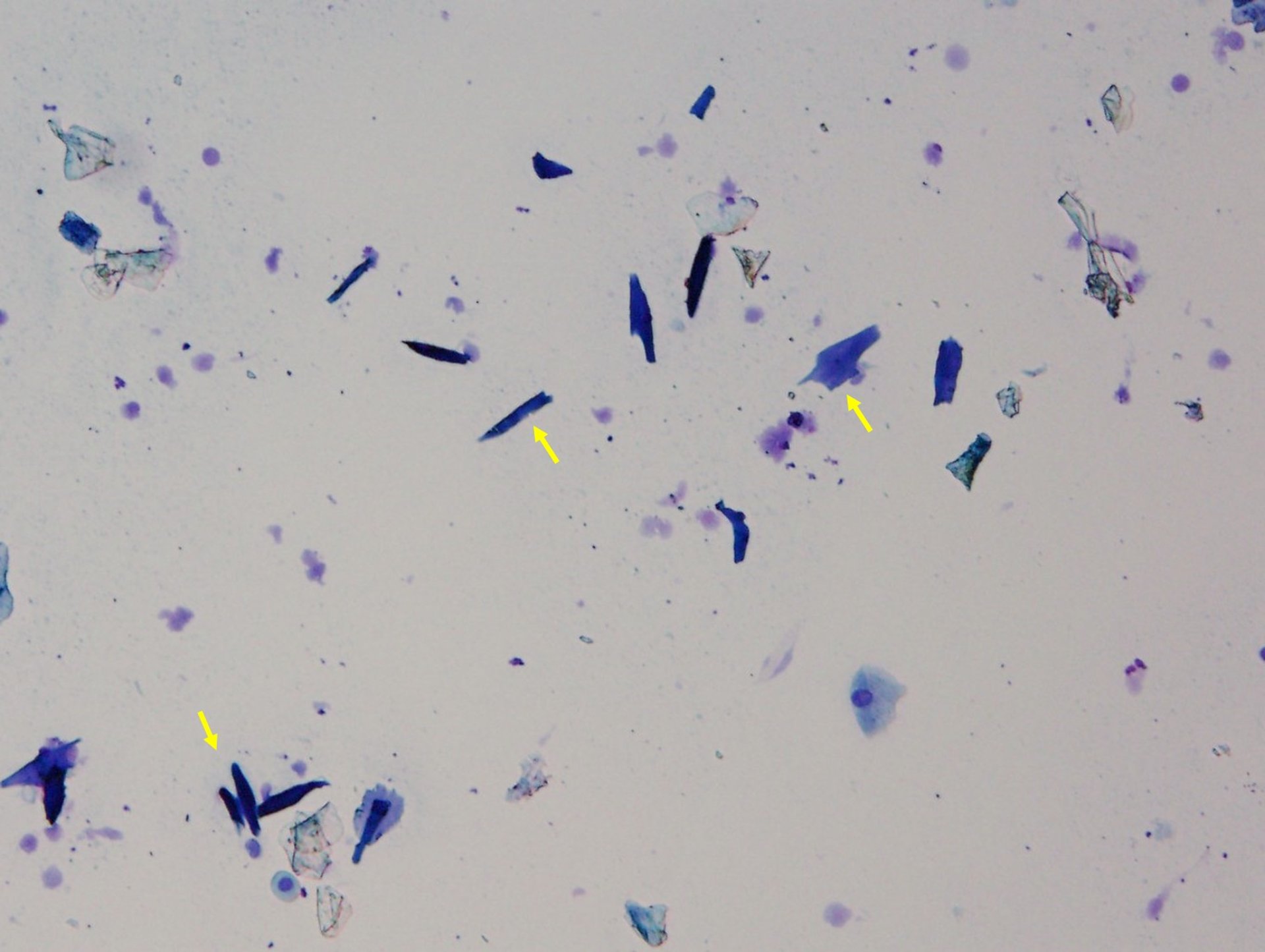 Image:Exfoliative cytology, vaginal canal, dog-Merck Veterinary Manual