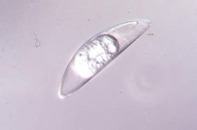 Image:Huevo de Syphacia muris-Manual de veterinaria de MSD