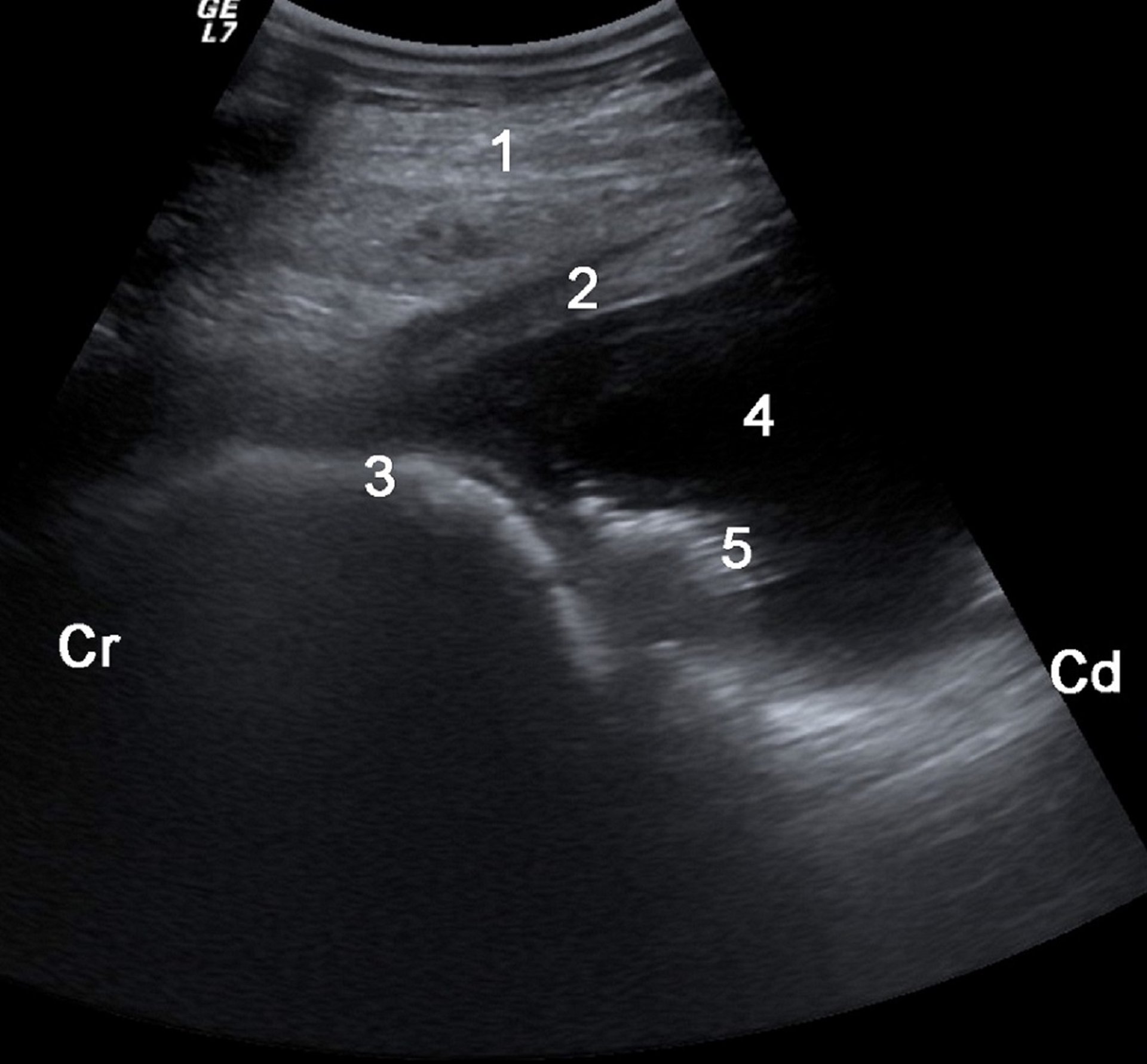 Traumatic Reticuloperitonitis in Cattle - Digestive System - MSD ...