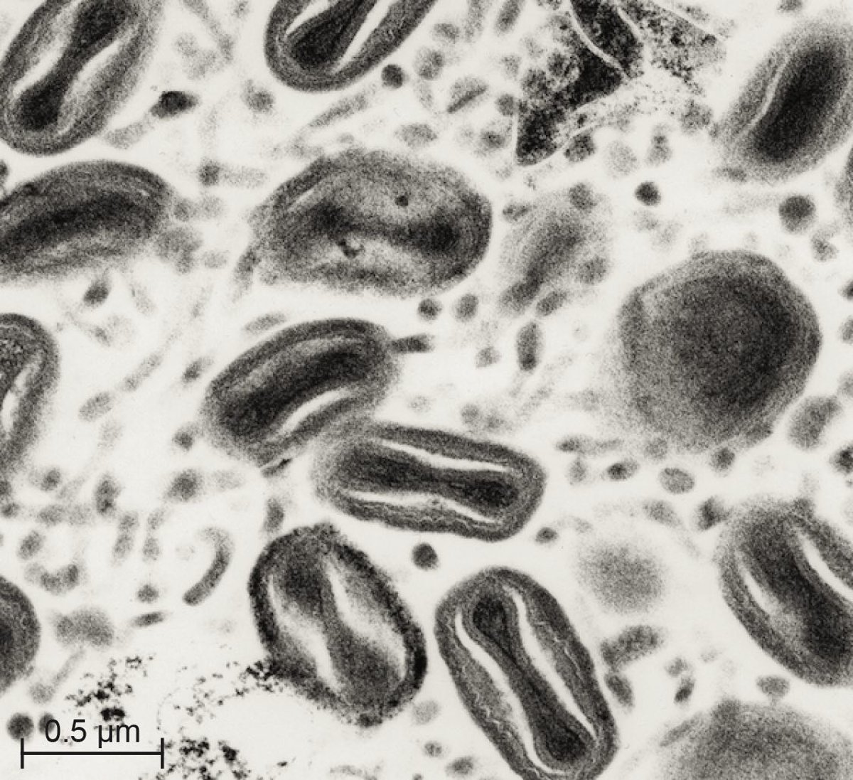 Fowlpox in Chickens and Turkeys - Poultry - MSD Veterinary Manual