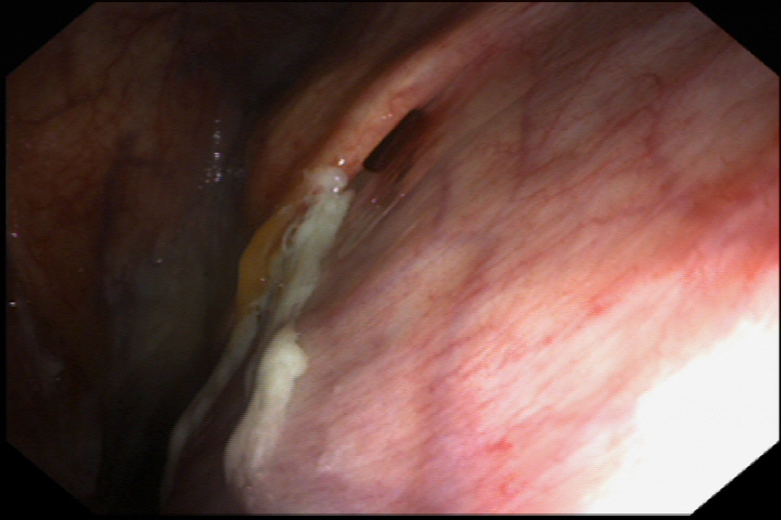 Image:Strangles, horse, pharynx-MSD Veterinary Manual