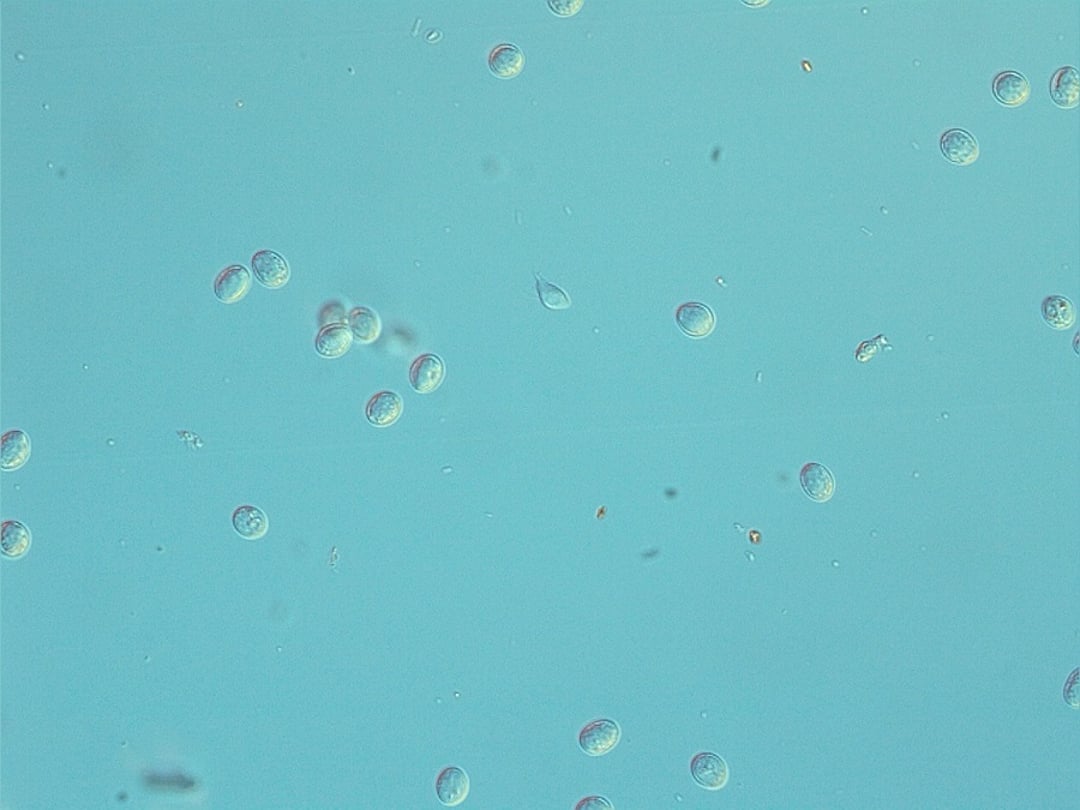 Giardiasis en animales - Aparato digestivo - Manual de veterinaria de MSD