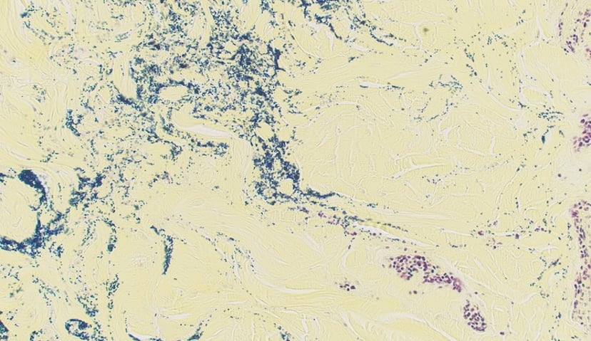 Image:Gram-positive Staphylococcus aureus in tissue, poultry-MSD ...