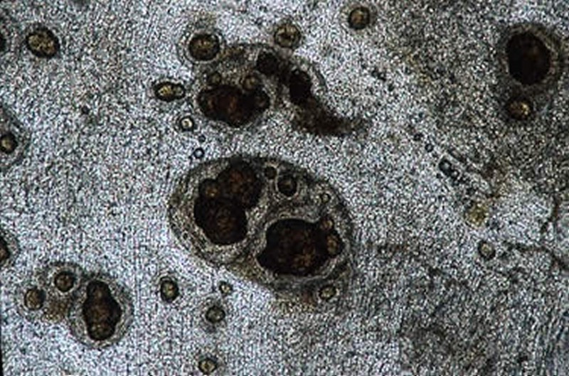 Image:Granulomas que sugieren infección por Cryptobia, cíclidos ...