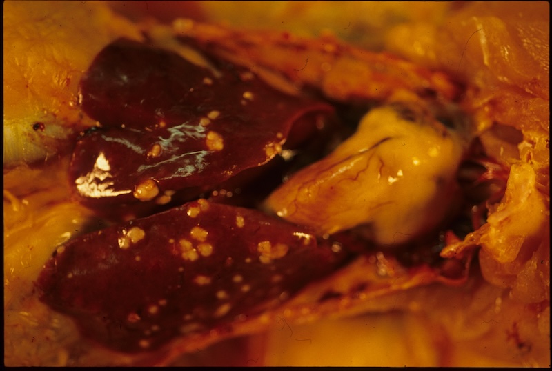 Image:Granulomatous hepatitis, liver, chicken-MSD Veterinary Manual