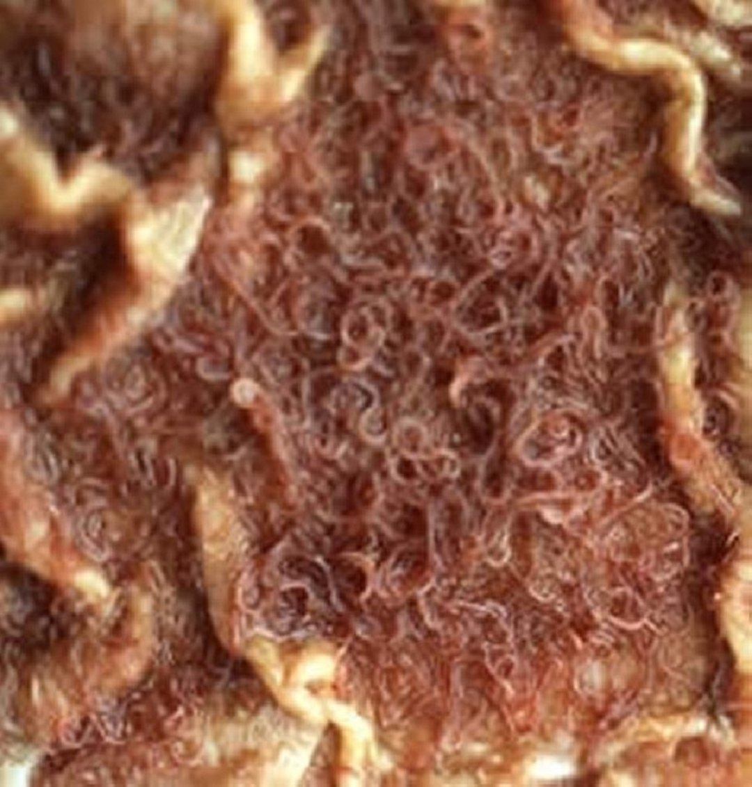 Image:Haemonchus contortus, abomasum, sheep-Merck Veterinary Manual