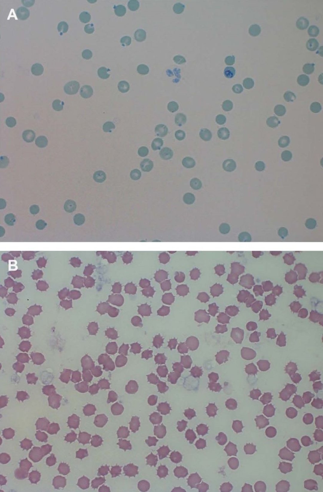 Overview of Anemia in Animals - Circulatory System - MSD Veterinary Manual