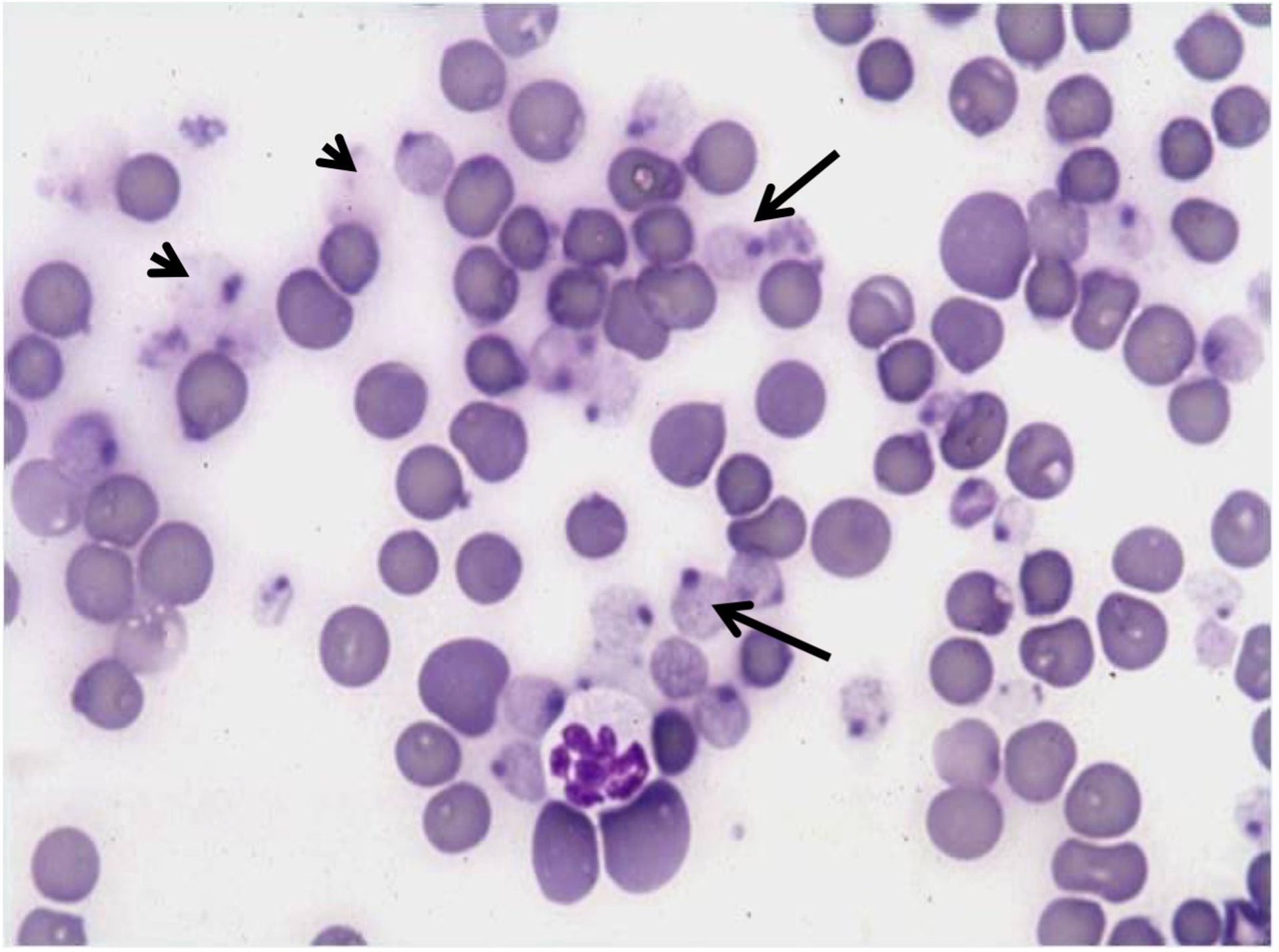 Hematology in Hepatic Disease in Small Animals - Digestive System ...